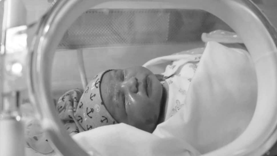 Bebé nació con una "cola humana" de 12 centímetros de largo y ...